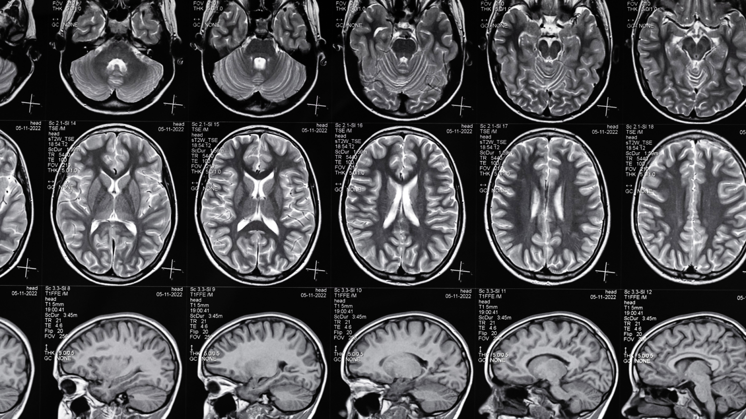 Overview of Brain Mapping and Neuroimaging – Society for Brain Mapping ...
