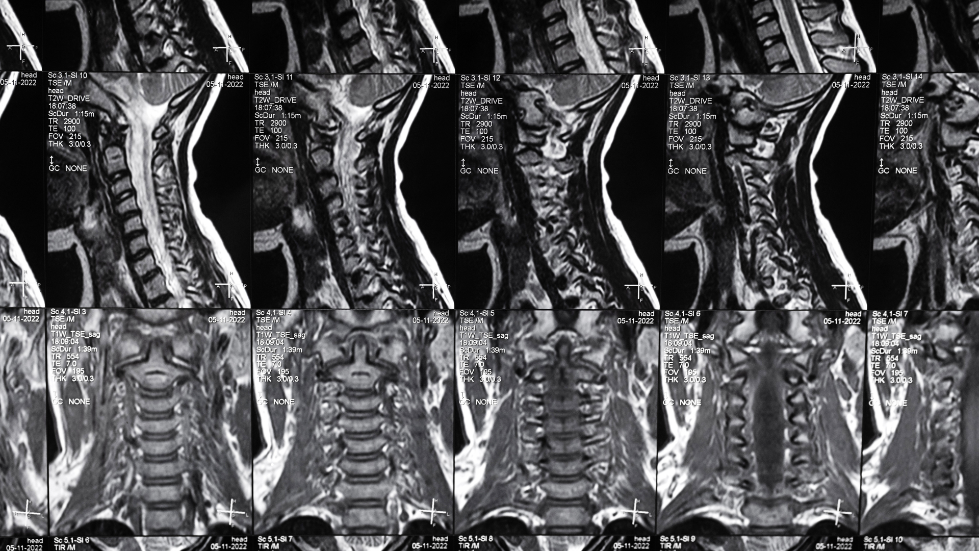 Historical Advancements in Neuroimaging Techniques - Society for Brain ...