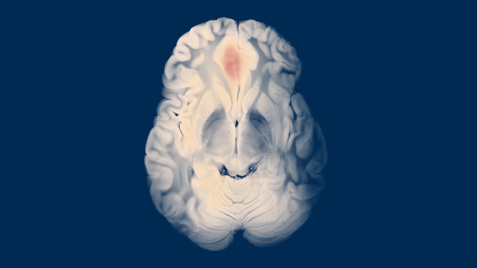 Ethical Considerations in Neuroimaging - Society for Brain Mapping and ...