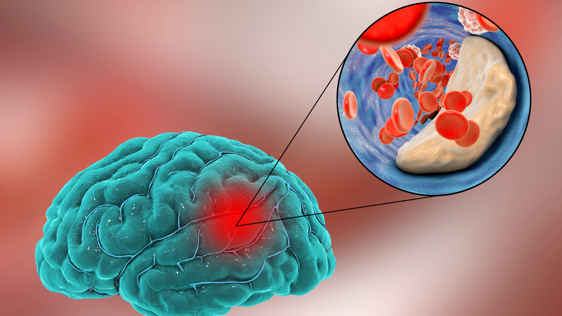 Clinical Applications of fMRI - Society for Brain Mapping and Therapeutics