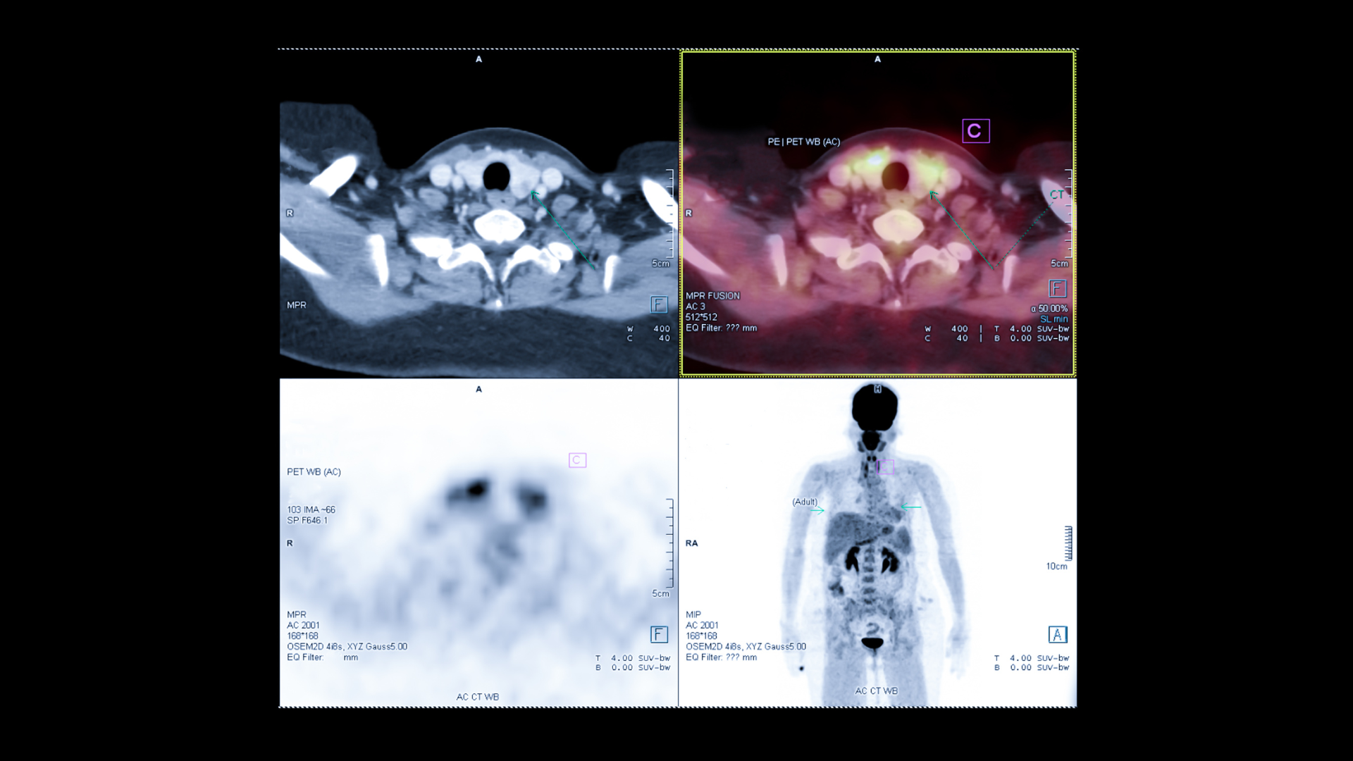 Fundamentals of PET Imaging – Society for Brain Mapping and Therapeutics
