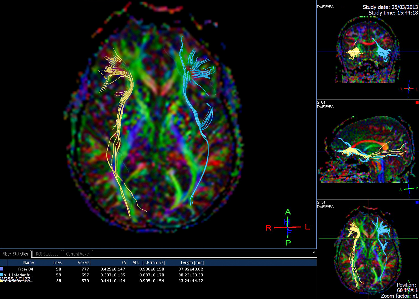 Clinical and Research Applications - Society for Brain Mapping and ...